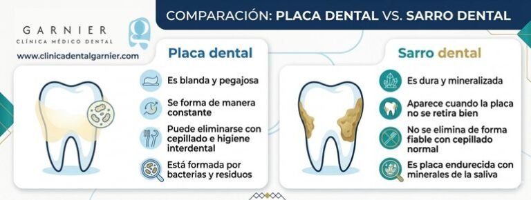 Sarro en los dientes: qué es, causas y cómo eliminarlo